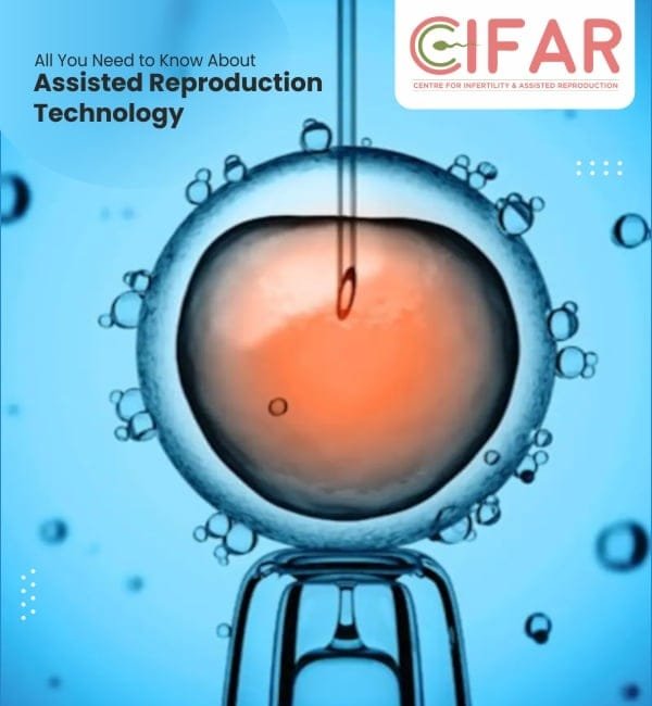 Assisted Reproduction Technology All You Need To Know